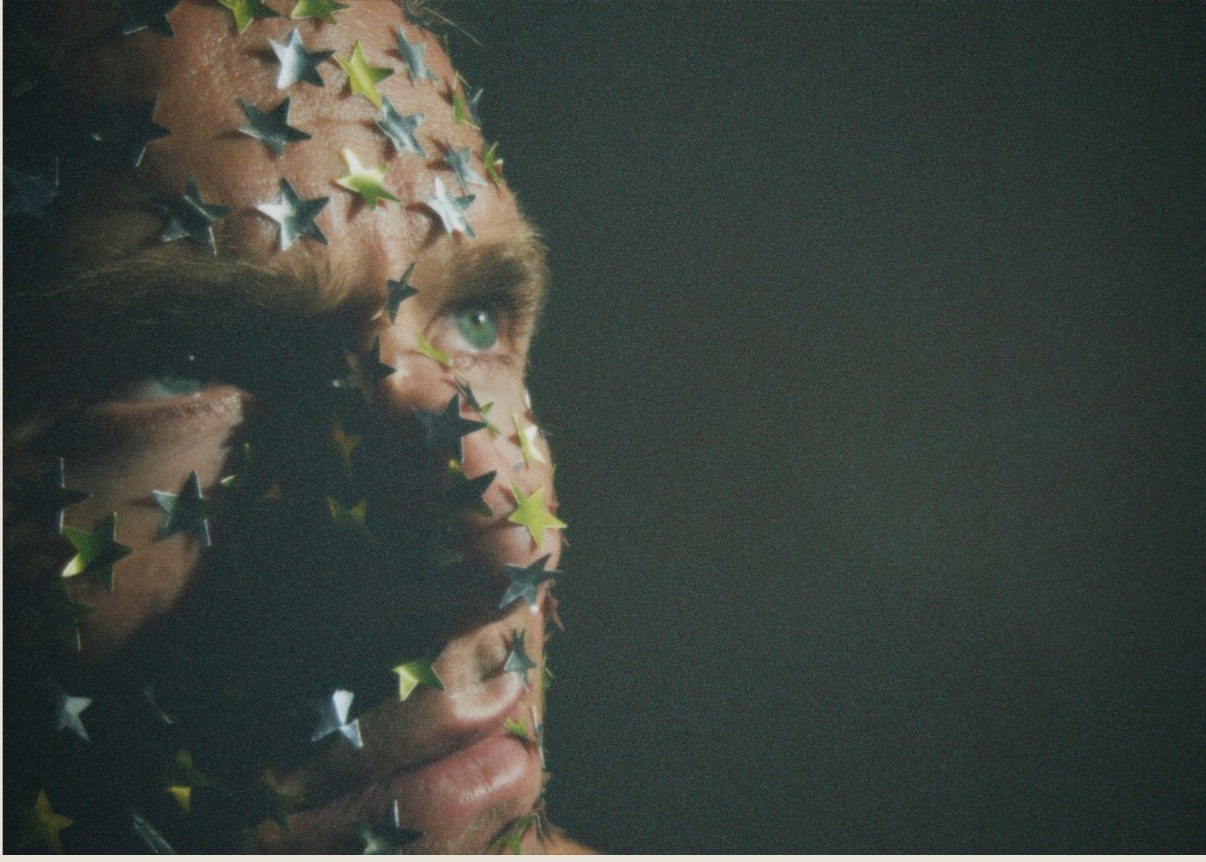 Acne: the crosstalk between skin and hormones – Temporal Matters